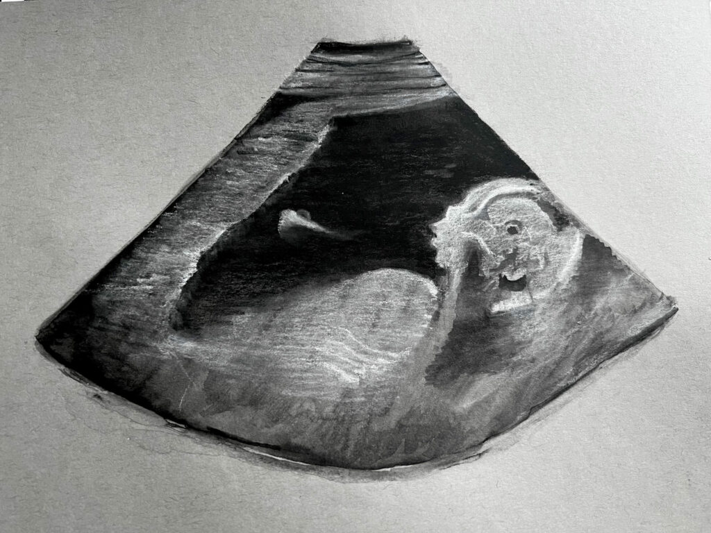 First Portrait – Rubor